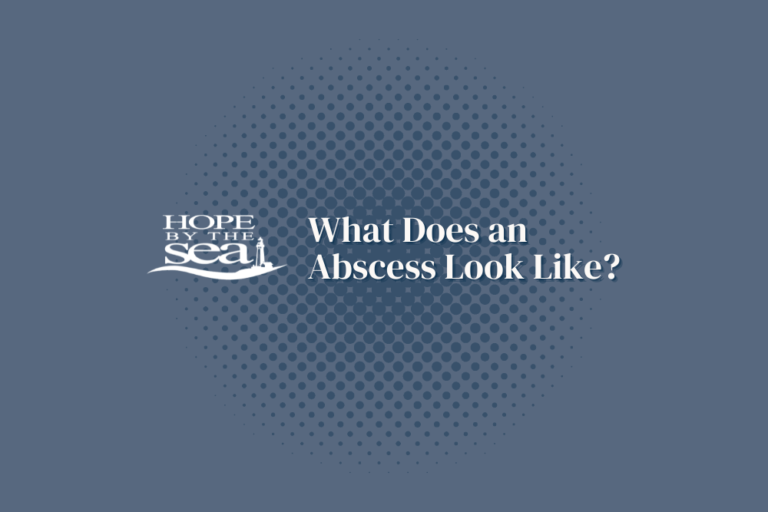 Abscess from IV Drug Use | What Does an Abscess Look Like